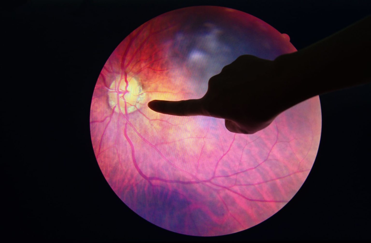 What Is A Diabetic Eye Exam Ottawa Downtown Eye Care what-is-a-diabetic-eye-exam-ottawa-downtown-eye-care